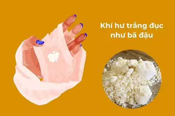 Khí hư bã đậu không mùi không ngứa: Hiện tượng sinh lý hay dấu hiệu ...